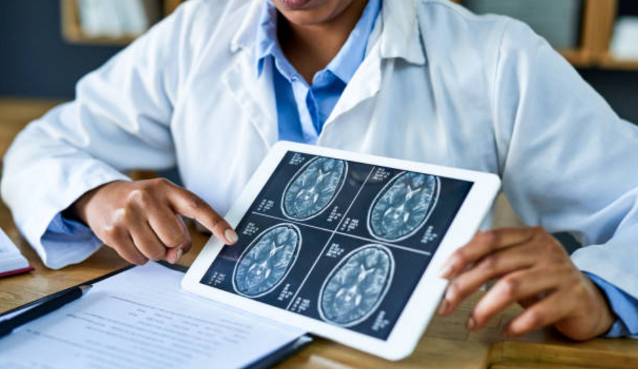 Brain Health Breakthrough: Researchers Investigate New Therapeutic ...