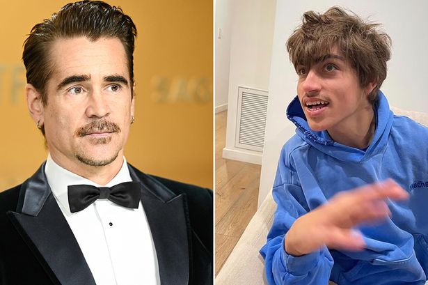 Inside Colin Farrell’s Toughest Choice: Why His Son with Angelman ...